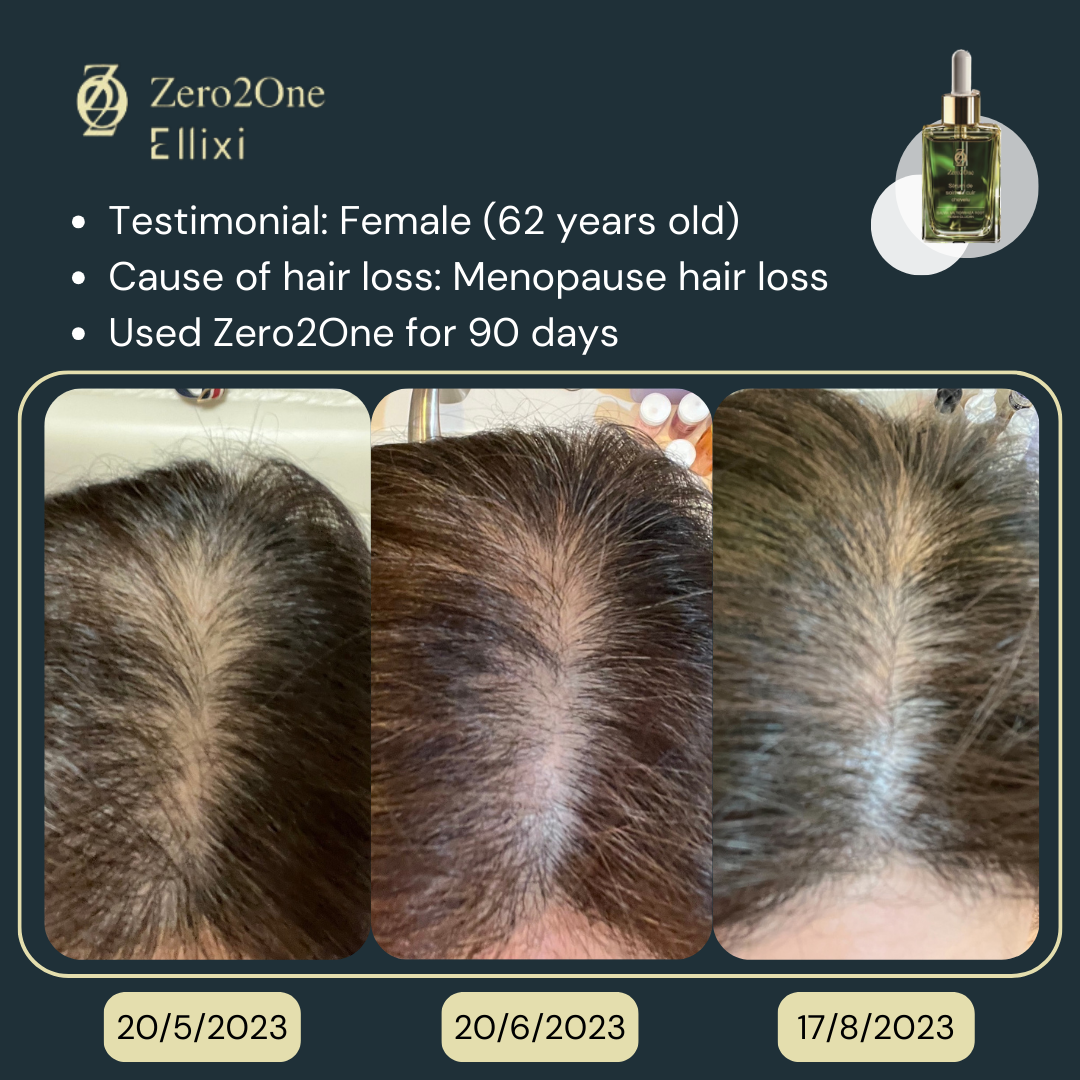 Zero2One Hair Tonic PLUS by Ellixi | FREE Ellixi Sanitizer - JML Singapore - Everyday Easier