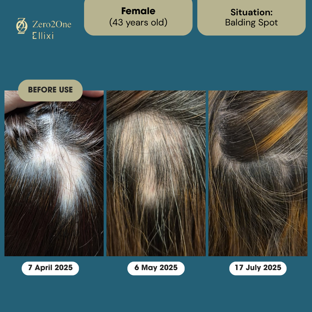 Zero2One Hair Tonic PLUS by Ellixi | FREE Ellixi Sanitizer - JML ...
