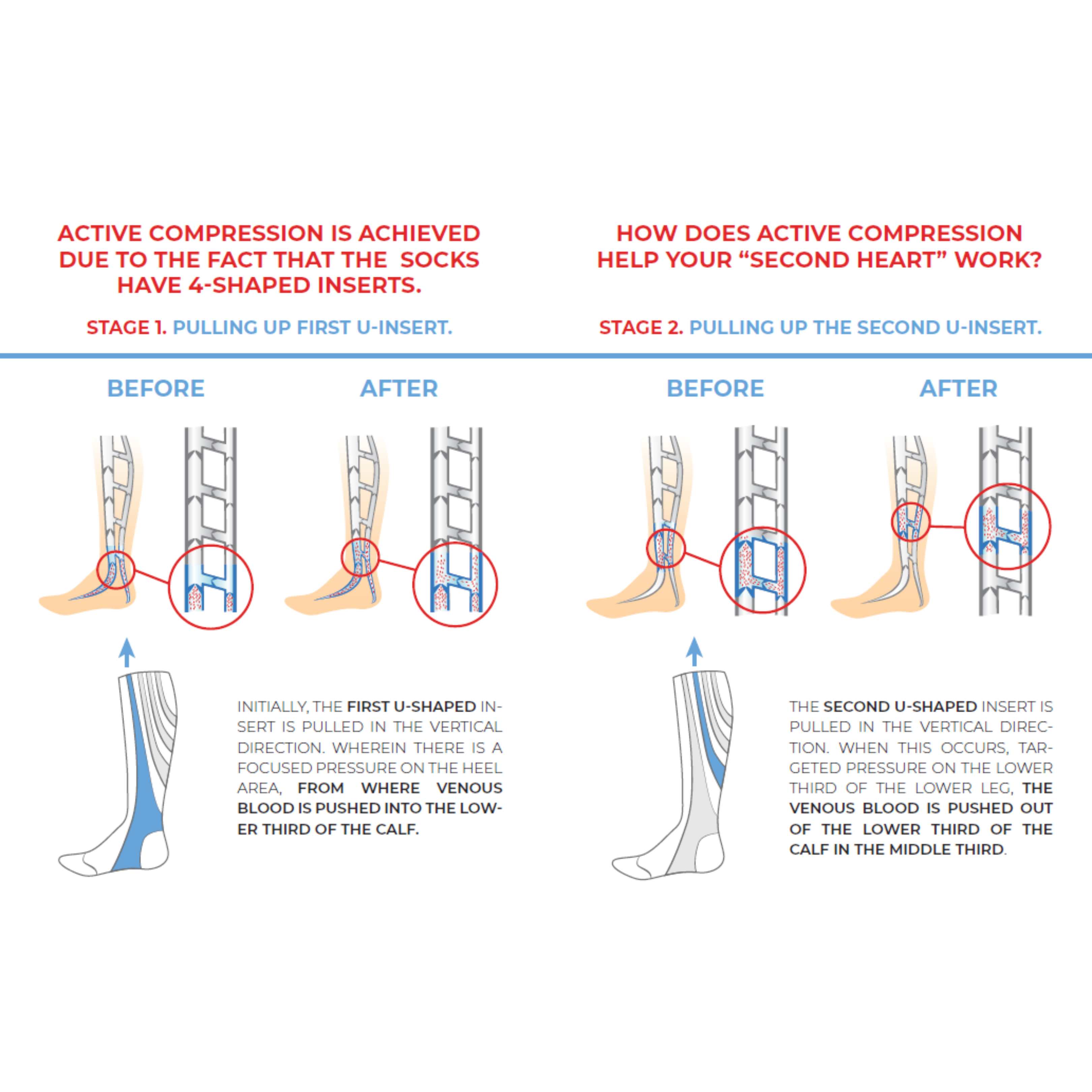 SANKOM Light Patent Socks - JML Singapore - Everyday Easier
